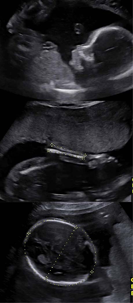 Perbezaan Ultrasound Scan: Jenis, Kegunaan & Bila Sesuai