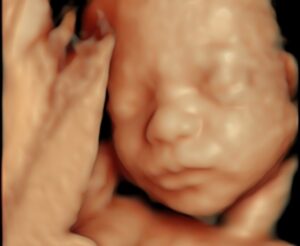 Perbezaan 2D, 3D, 4D, HD, 5D, 6D dan VR scan? | Private Ultrasound Scan ...