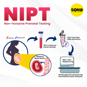 NIPT Test: Non-Invasive Prenatal Testing