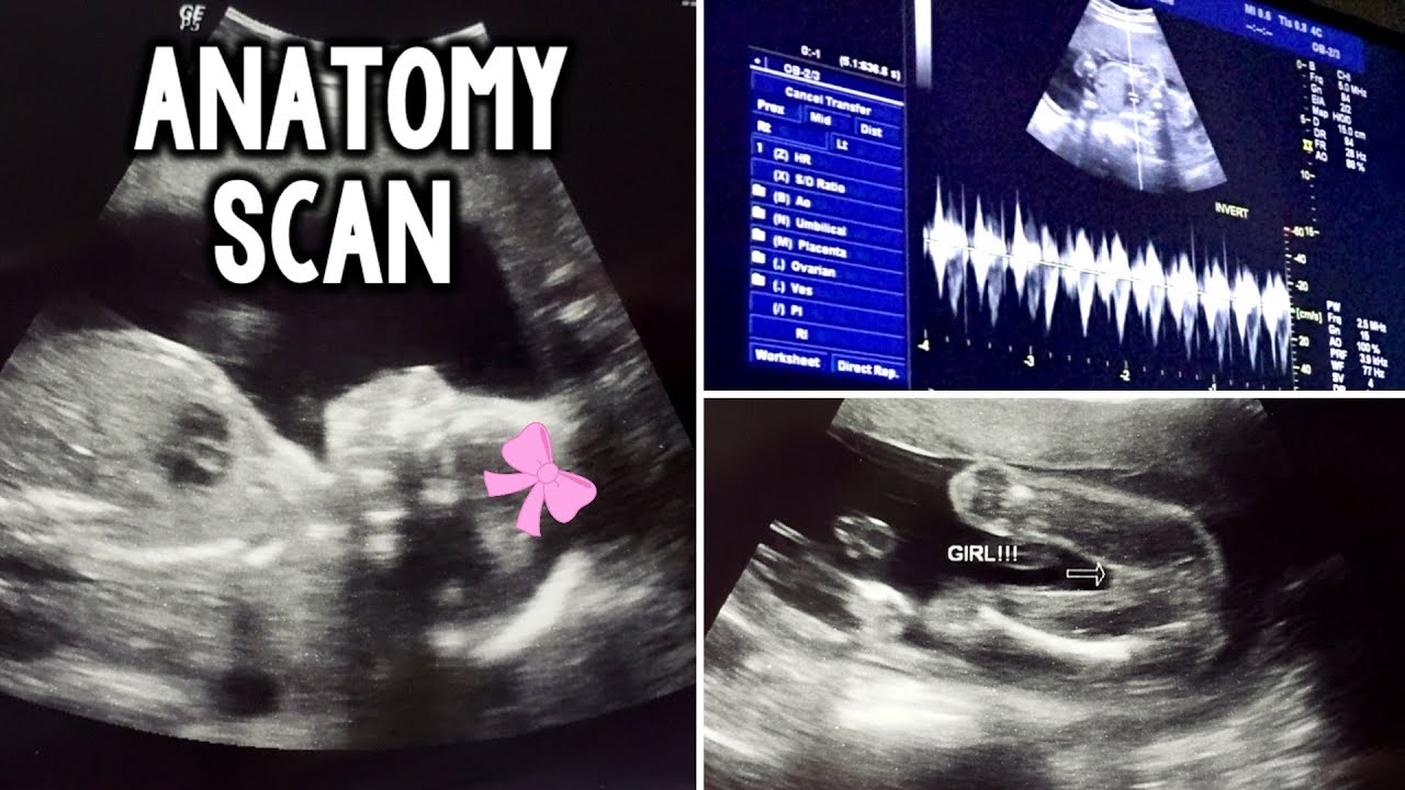Anatomy Scan Malaysia As low As RM88 | Anatomy Scan Center in Malaysia