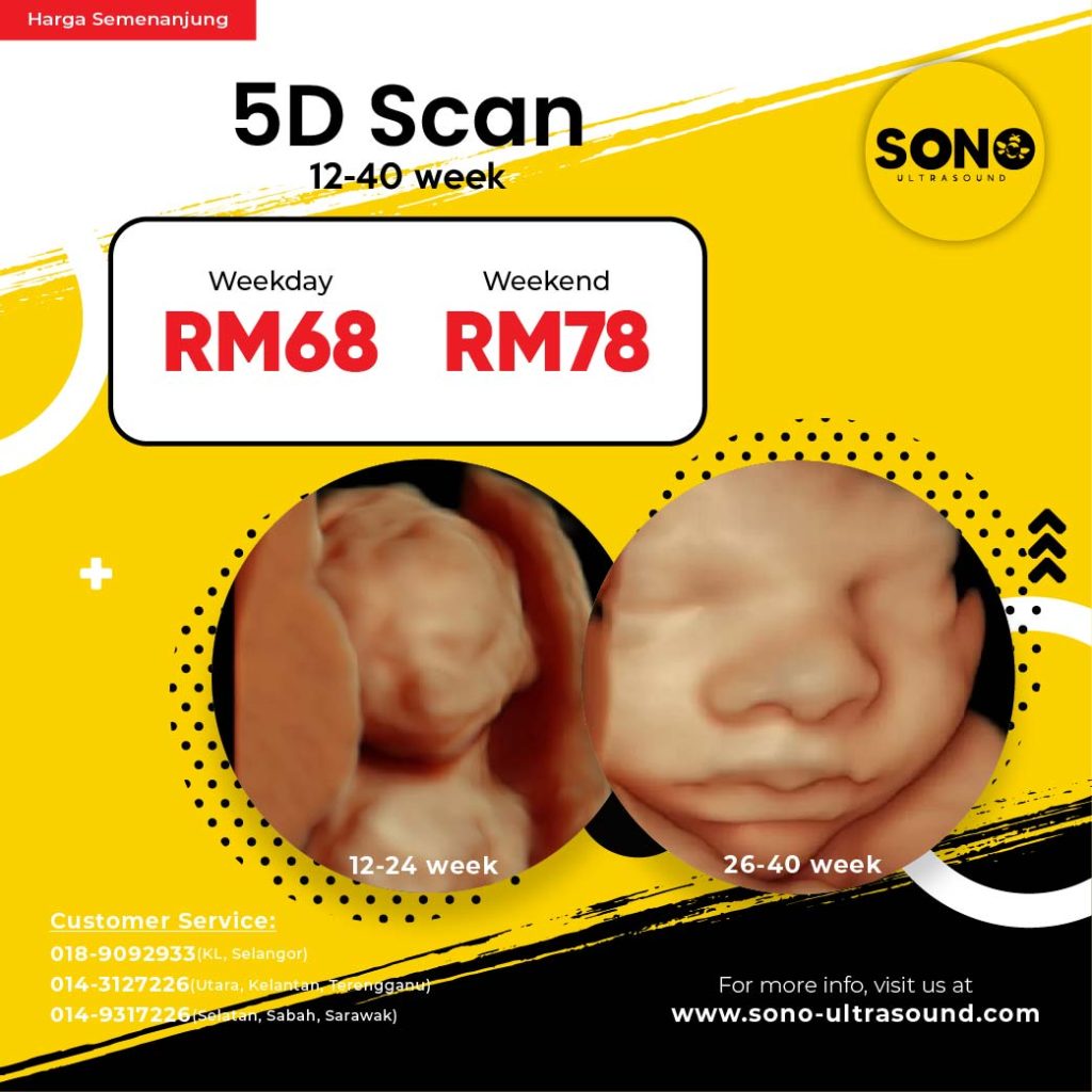 Sonobee Ultrasound Scan Center Kedah | Baby Scans & Pregnancy Imaging